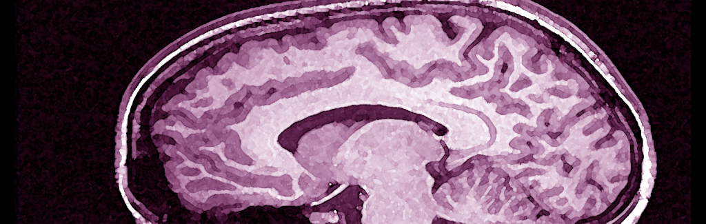 Publications – Cognitive and Pharmacological Neuroimaging Unit